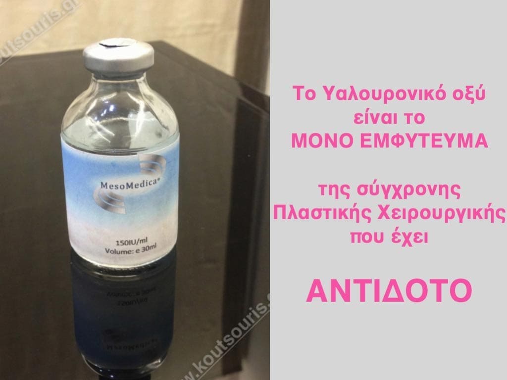 Ρινοπλαστική χωρίς χειρουργείο (Πλαστική μύτης) - Κουτσούρης