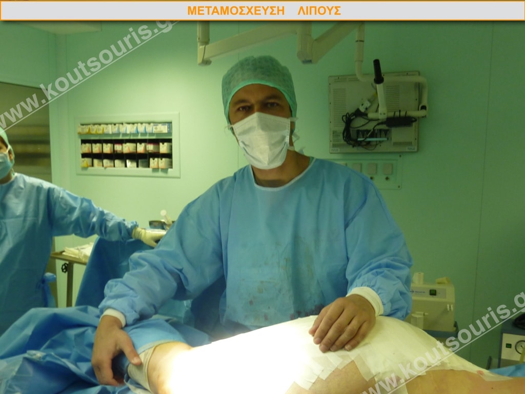 Αυξητικη γλουτων - Μιχάλης Κουτσούρης