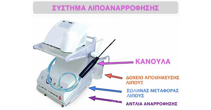 Λιποαναρρόφηση — Μιχάλης Κουτσούρης